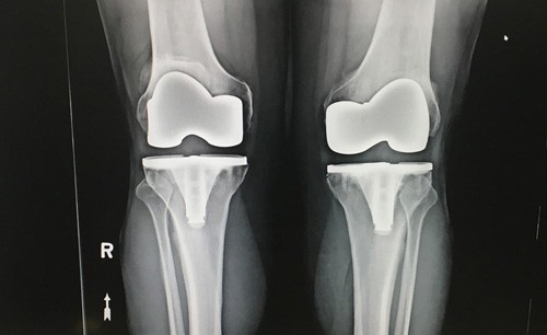 image1-copy.jpg | Canon RF Shooters Forums